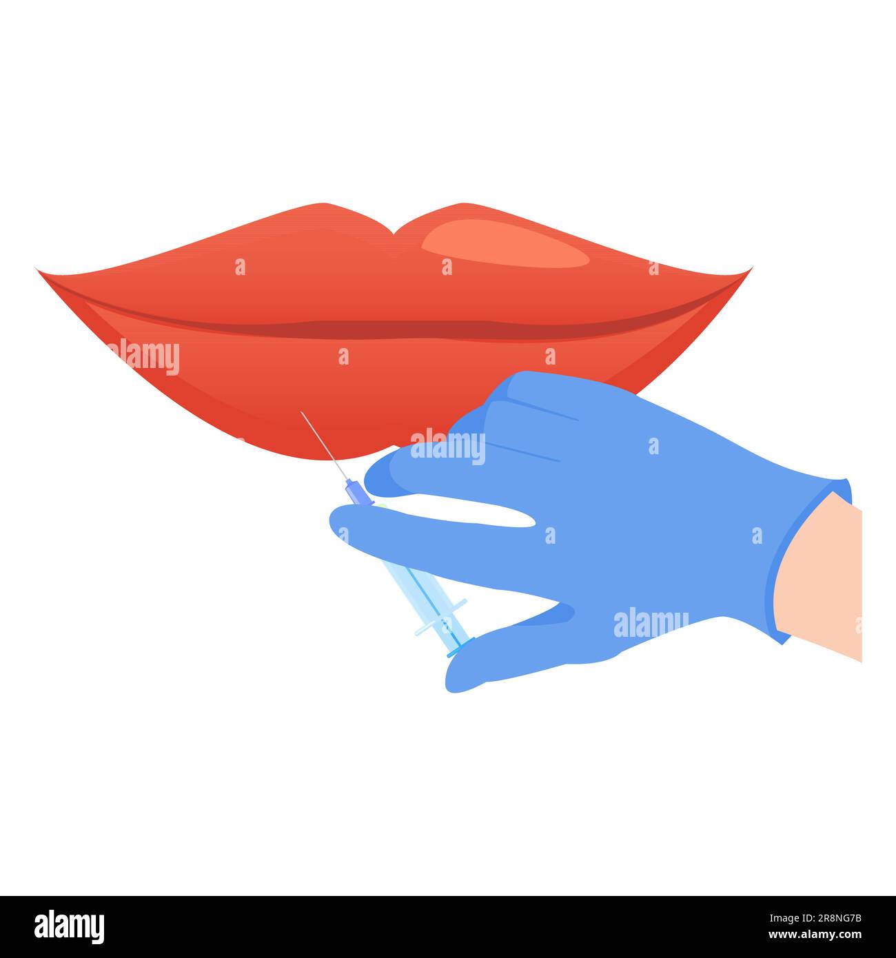 Lip plumping augmentation with filler injection illustration Stock ... Lip plumping augmentation with filler injection illustration Stock ...