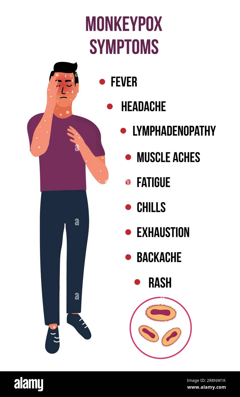 Monkeypox cases Stock Vector Images - Alamy