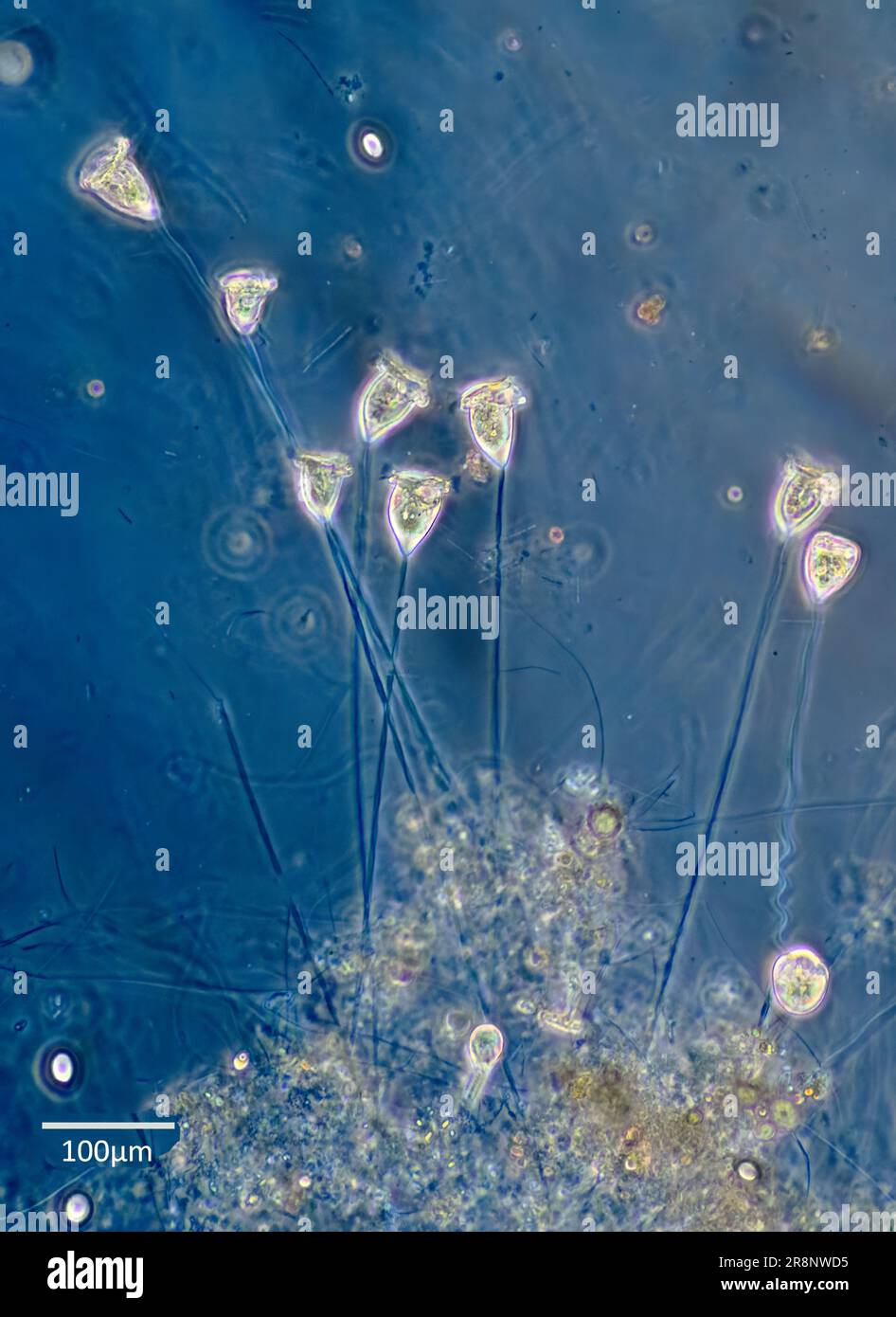 Feeding ciliates from the genus Vorticella (or Pseudovorticella ...