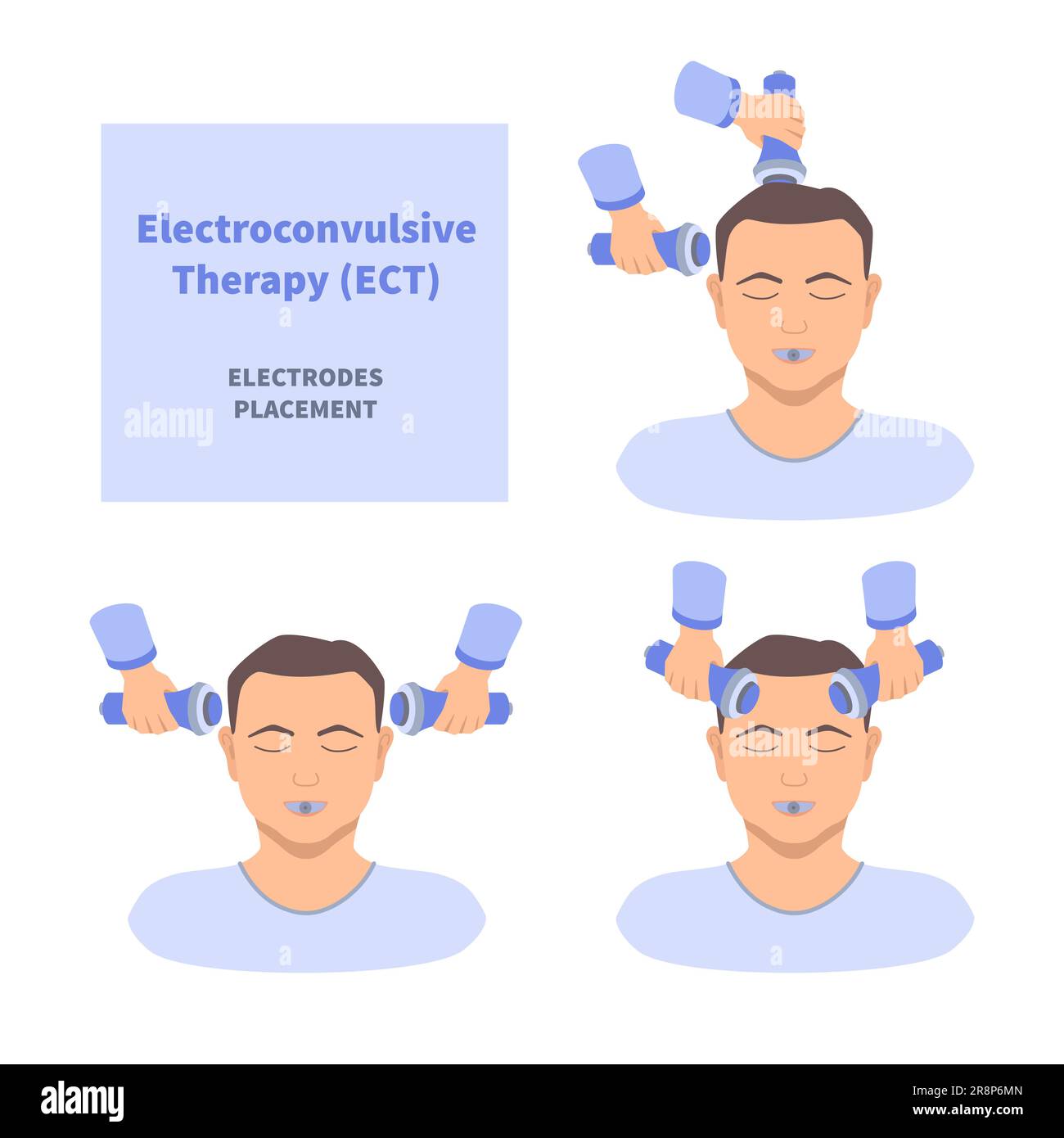 ECT electroconvulsive therapy for severe depression treatment Stock ...
