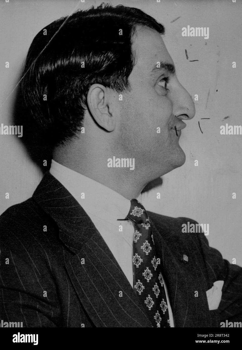 His Face Is His Fortune -- "What if they do make jokes about my nose ...