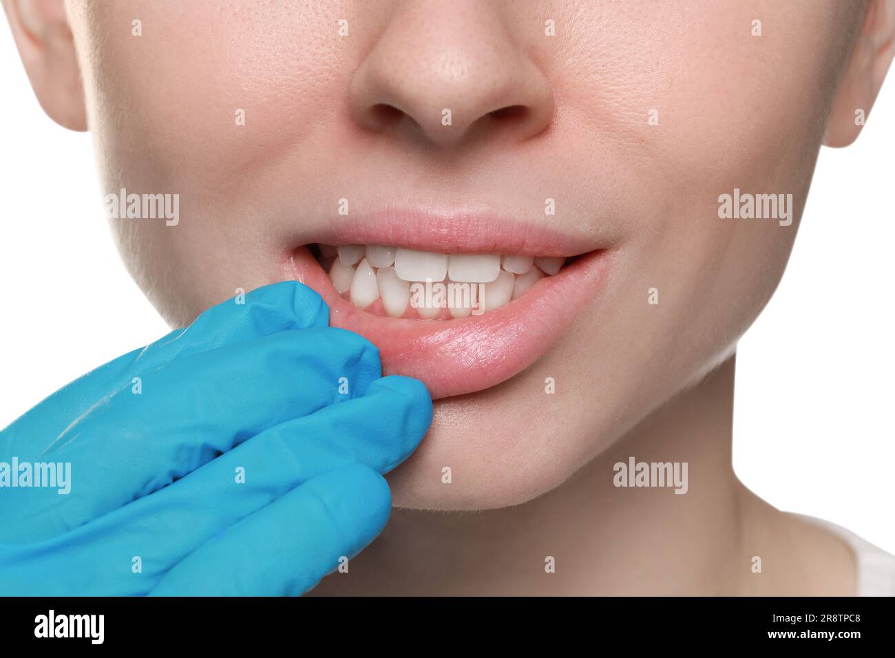 Doctor examining woman's gums on white background, closeup Stock Photo ...