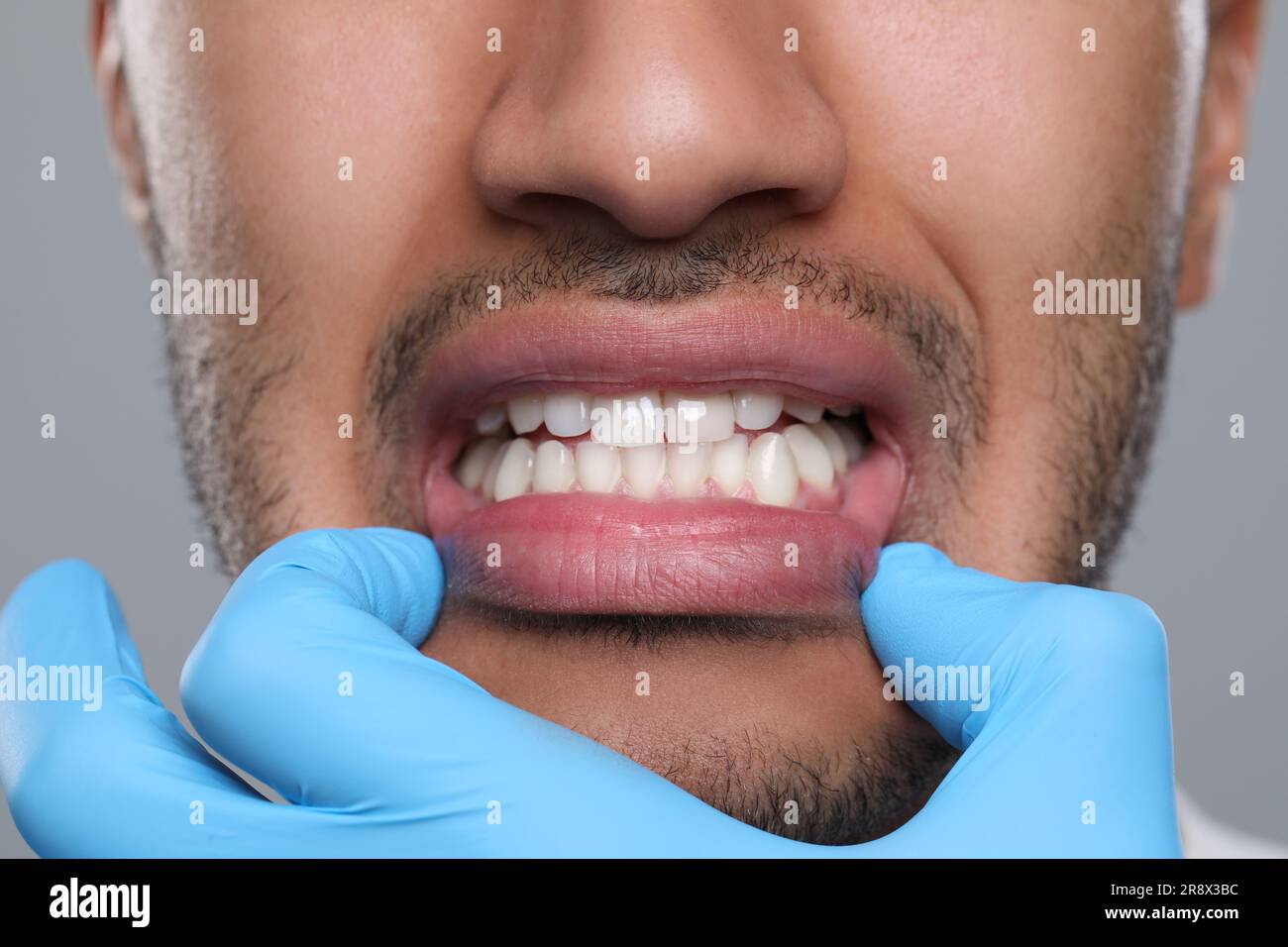 Dentist examining man's gums on grey background, closeup Stock Photo ...