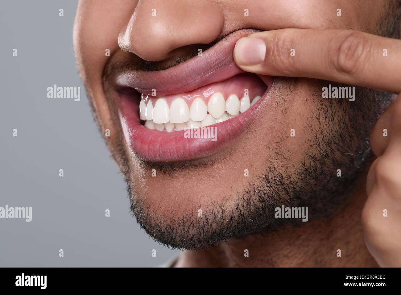 Grey gums hi-res stock photography and images - Alamy