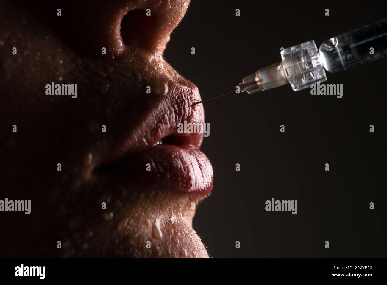 Lips Cosmetology. Hyaluronic acid injection. Procedure of lip ...