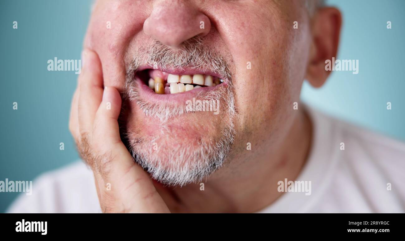 Sore Tooth And Decay. Man Dental Health. Teeth And Mouth Stock Photo ...