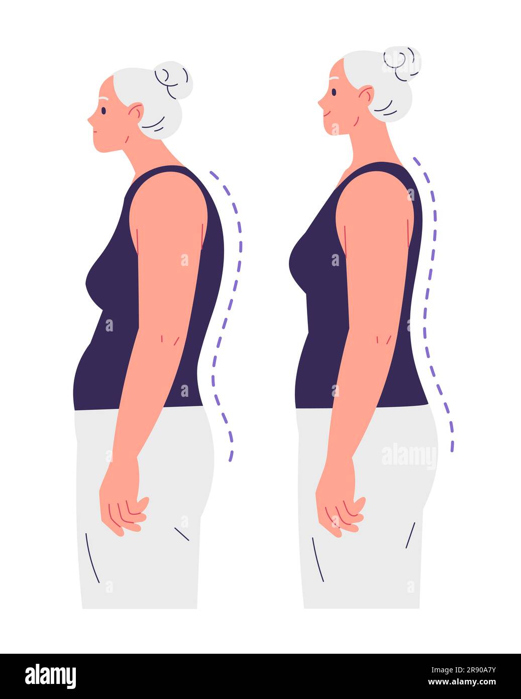 Elderly woman with impaired posture and correct posture Stock Vector ...
