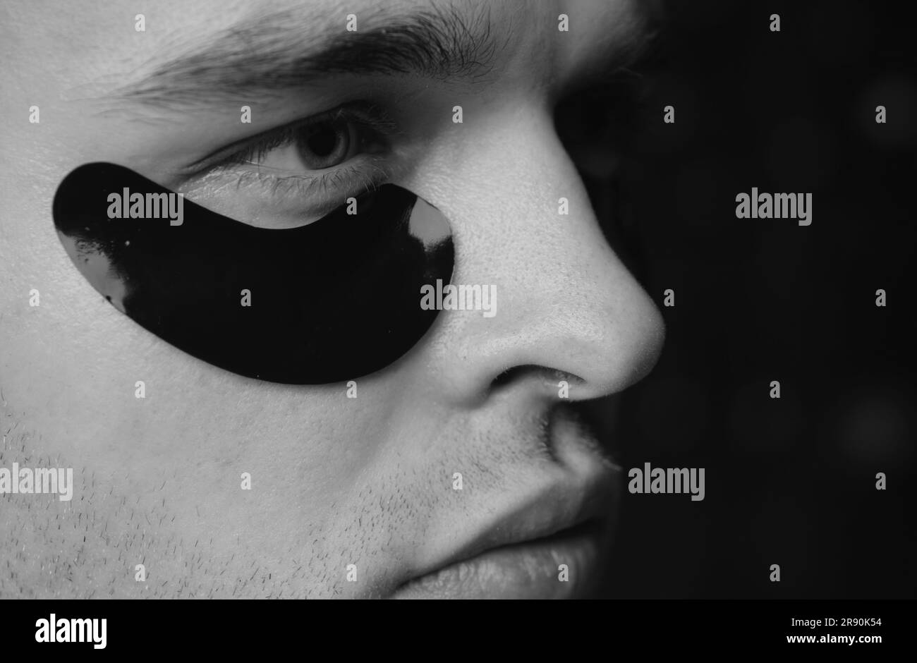 Man face with flakes under the eyes. Mans flakes. Patches under close ...