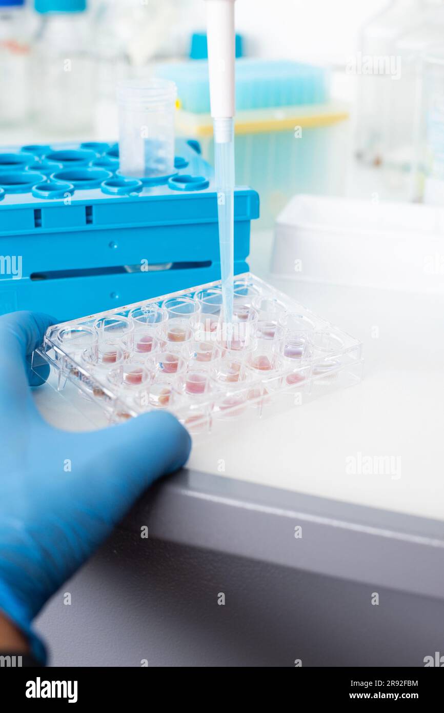 In vitro cellular assay using multi pipette and well plate cell culture ...