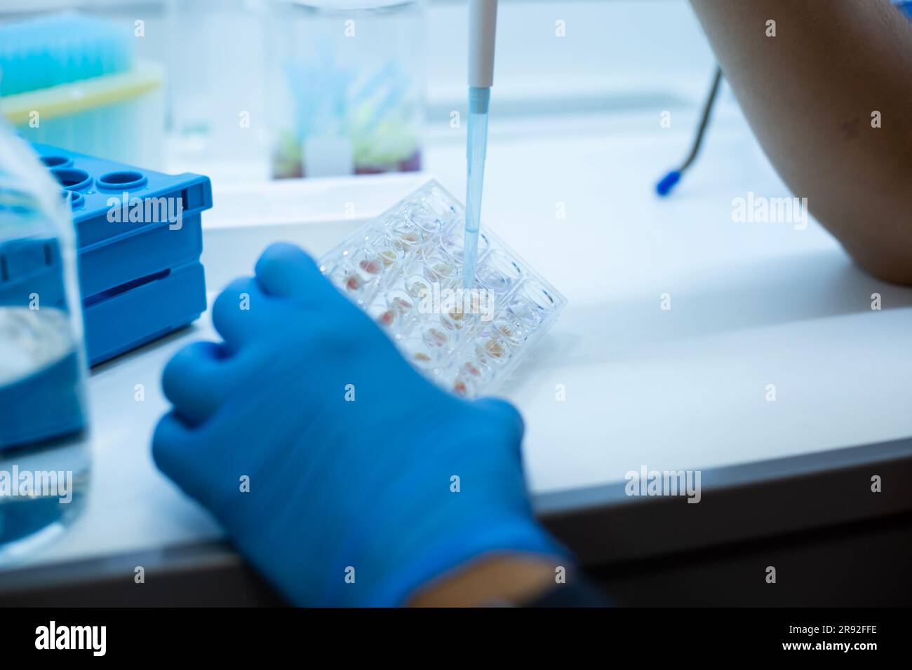 In vitro cellular assay using multi pipette and well plate cell culture ...