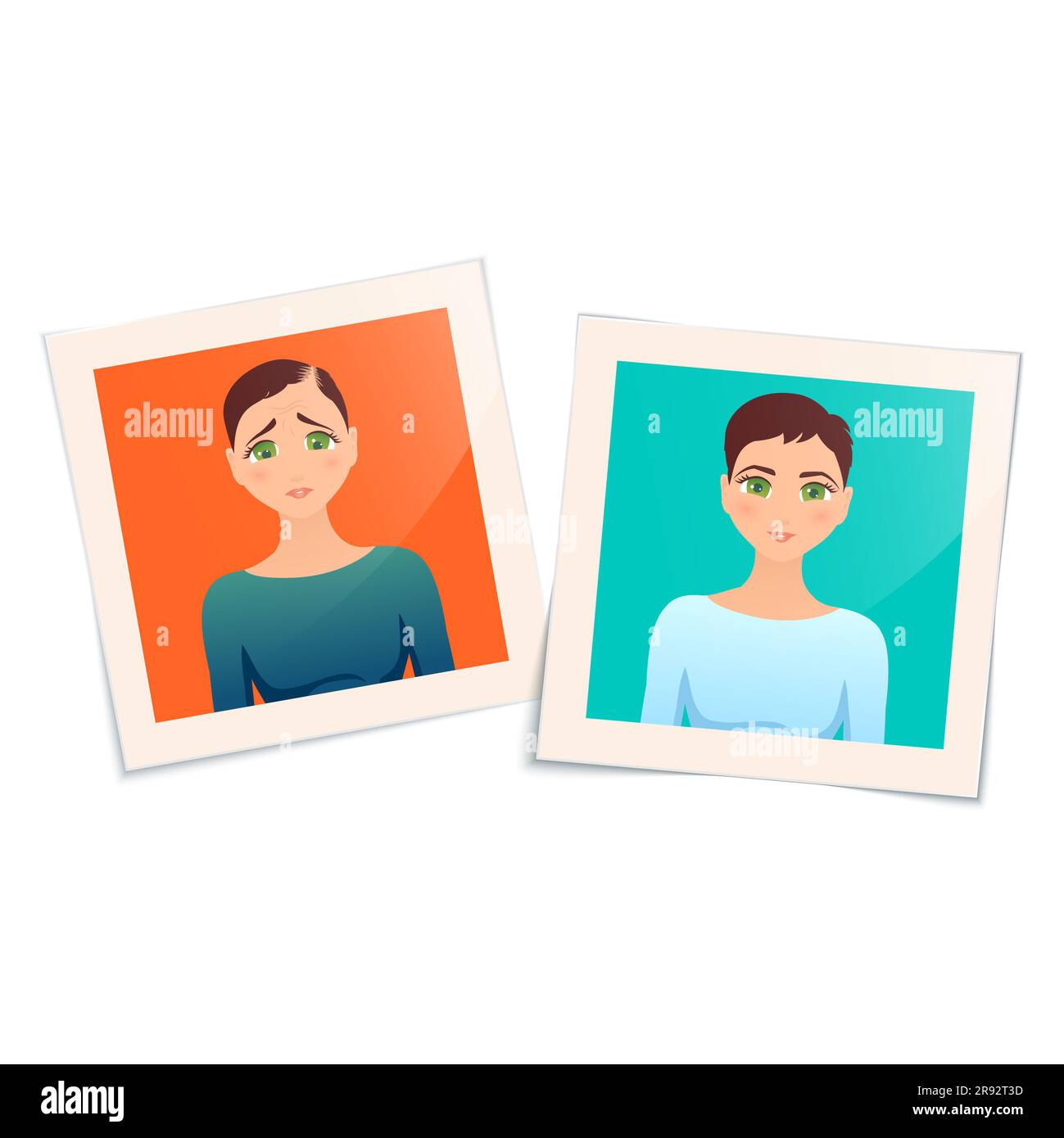 Female alopecia treatment, conceptual illustration Stock Photo - Alamy Female alopecia treatment, conceptual illustration Stock Photo - Alamy