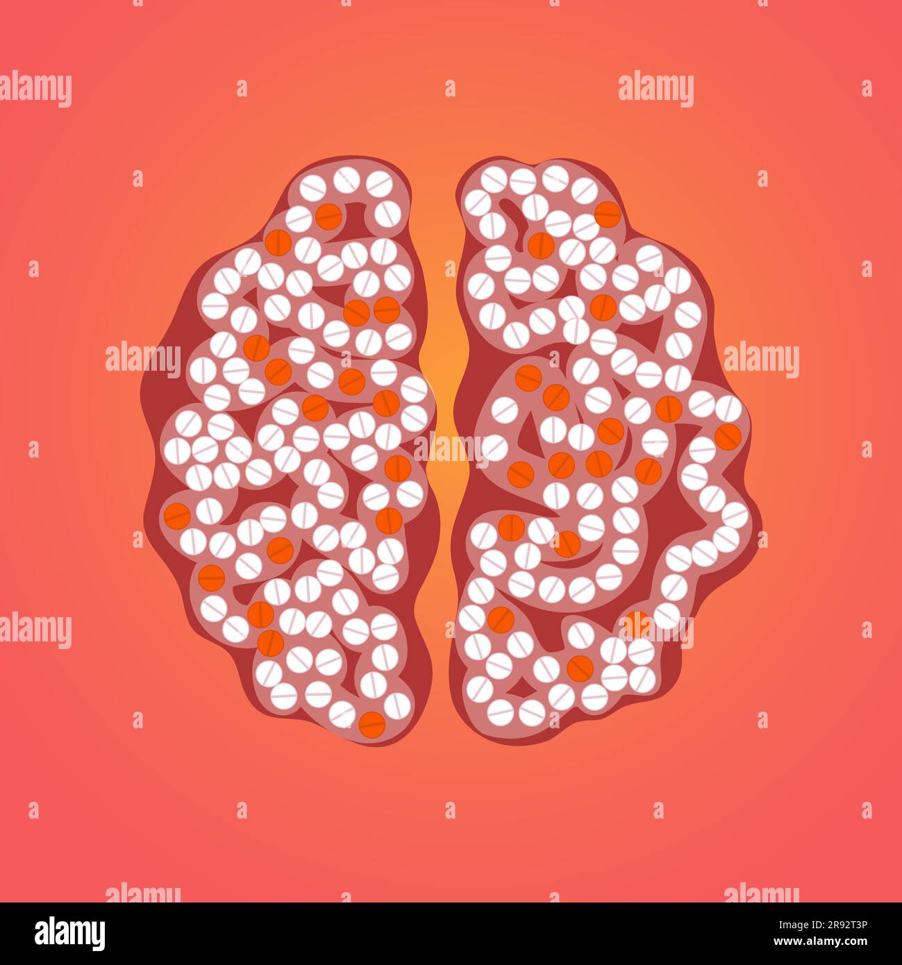 Multiple sclerosis brain hi-res stock photography and images - Alamy
