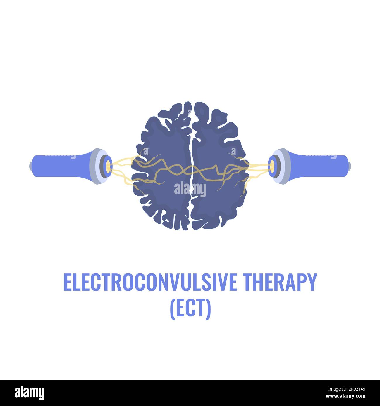 Electroconvulsive therapy, illustration Stock Photo - Alamy