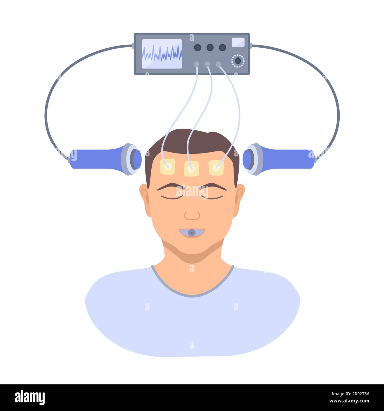 Electroconvulsive therapy (ECT), illustration Stock Photo - Alamy