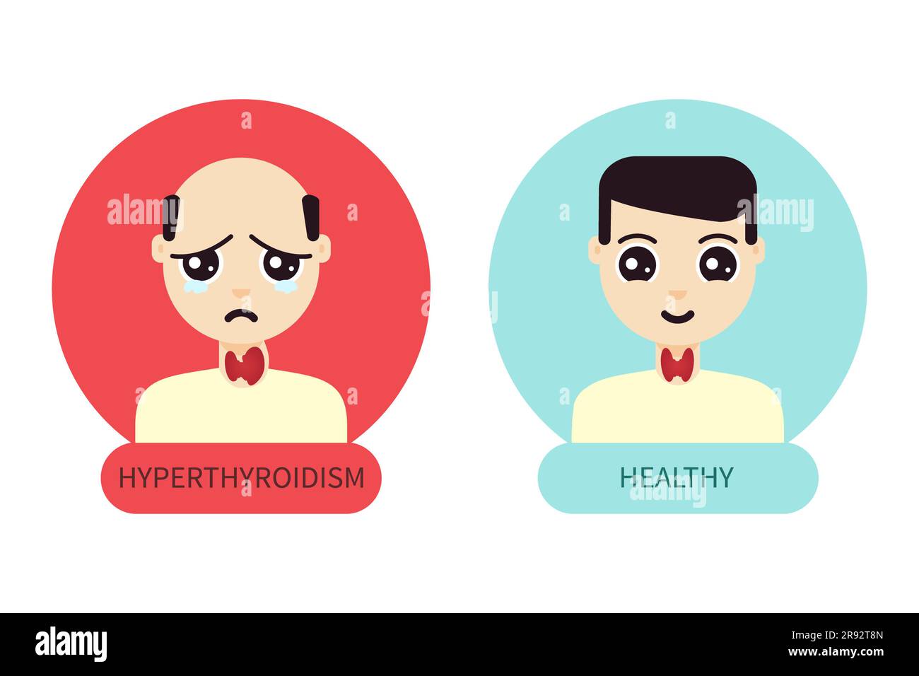 Hyperthyroidism treatment, conceptual illustration Stock Photo - Alamy