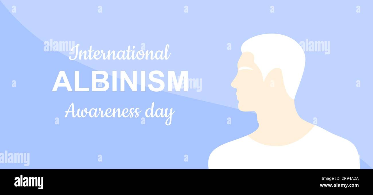 Albino man profile on a soft blue background. International albinism ...