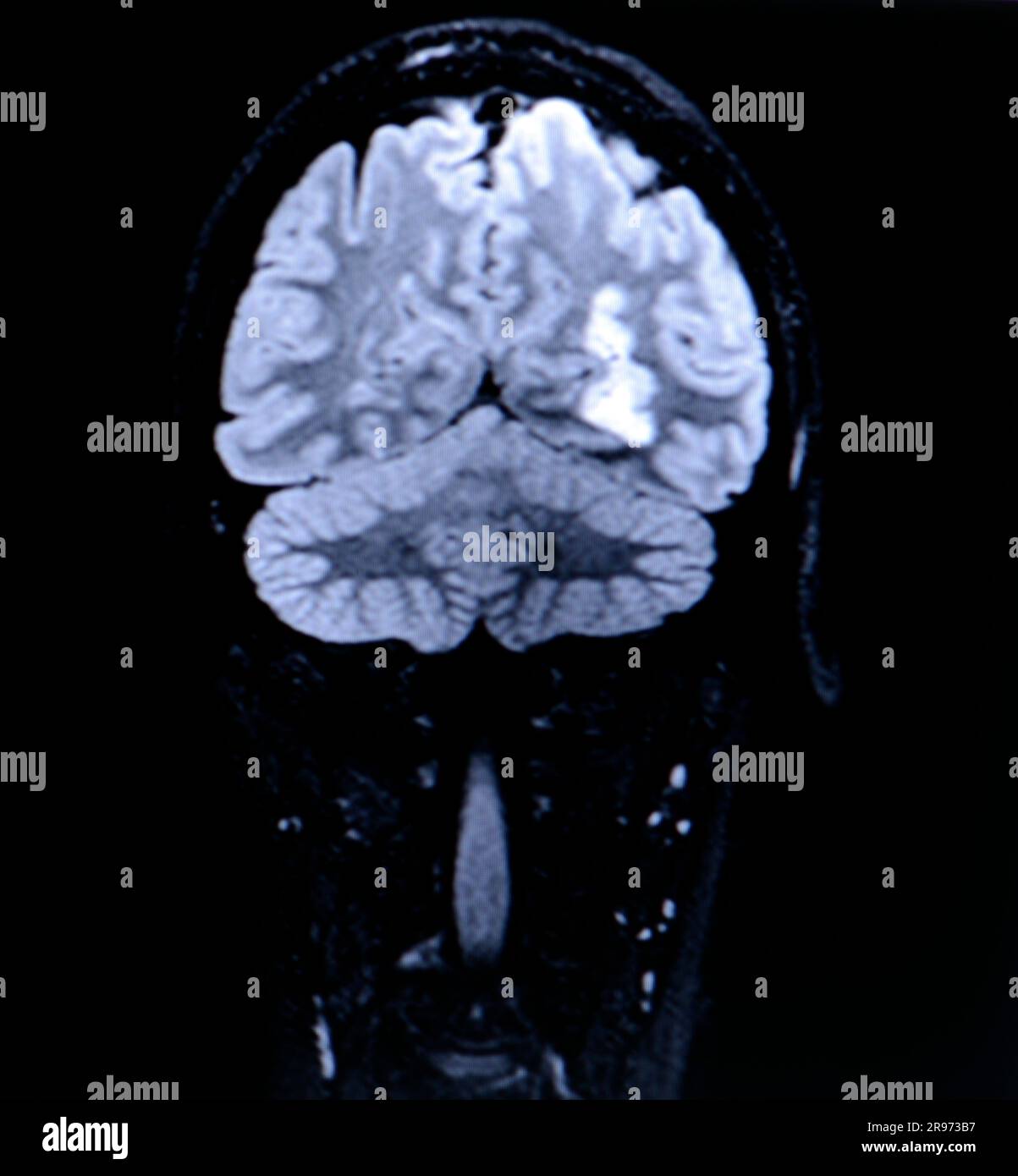 Human anatomy brain nerv system hi-res stock photography and images - Alamy