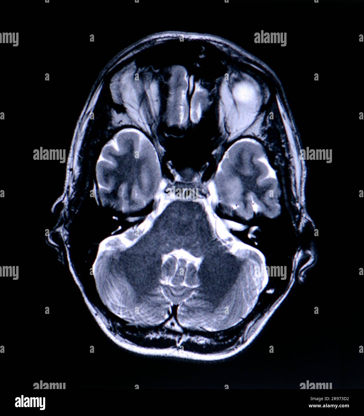 Human brain cells hi-res stock photography and images - Alamy