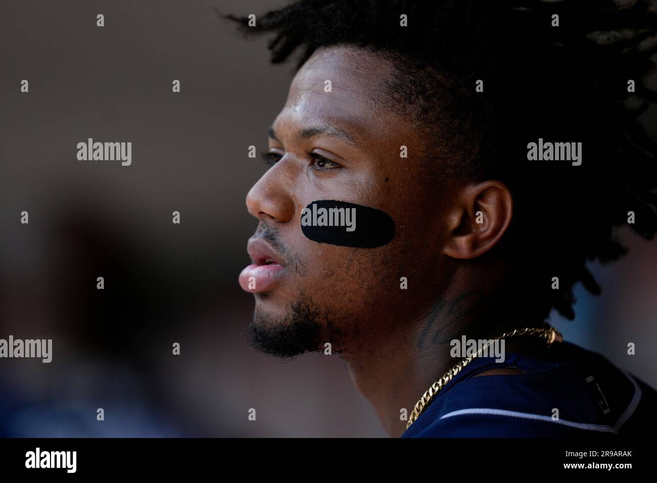 Atlanta Braves' Ronald Acuna Jr. sits in the dugout during the third ...