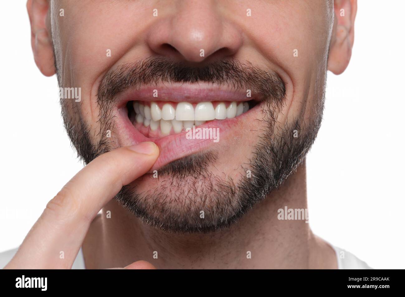 Man showing healthy gums on white background, closeup Stock Photo - Alamy