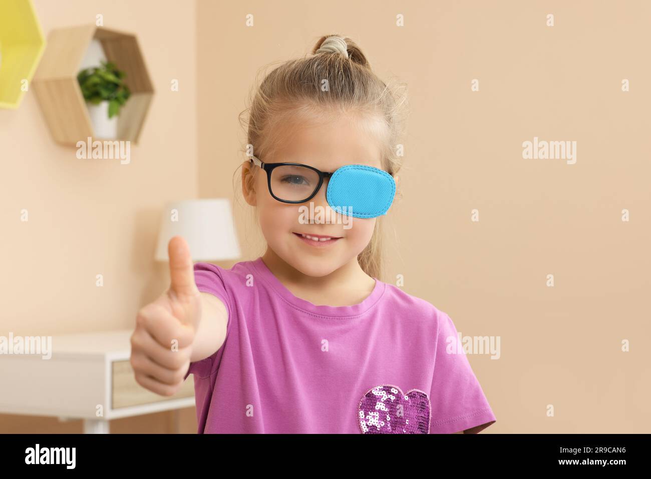 Girl with eye patch on glasses showing thumb up in room. Strabismus ...