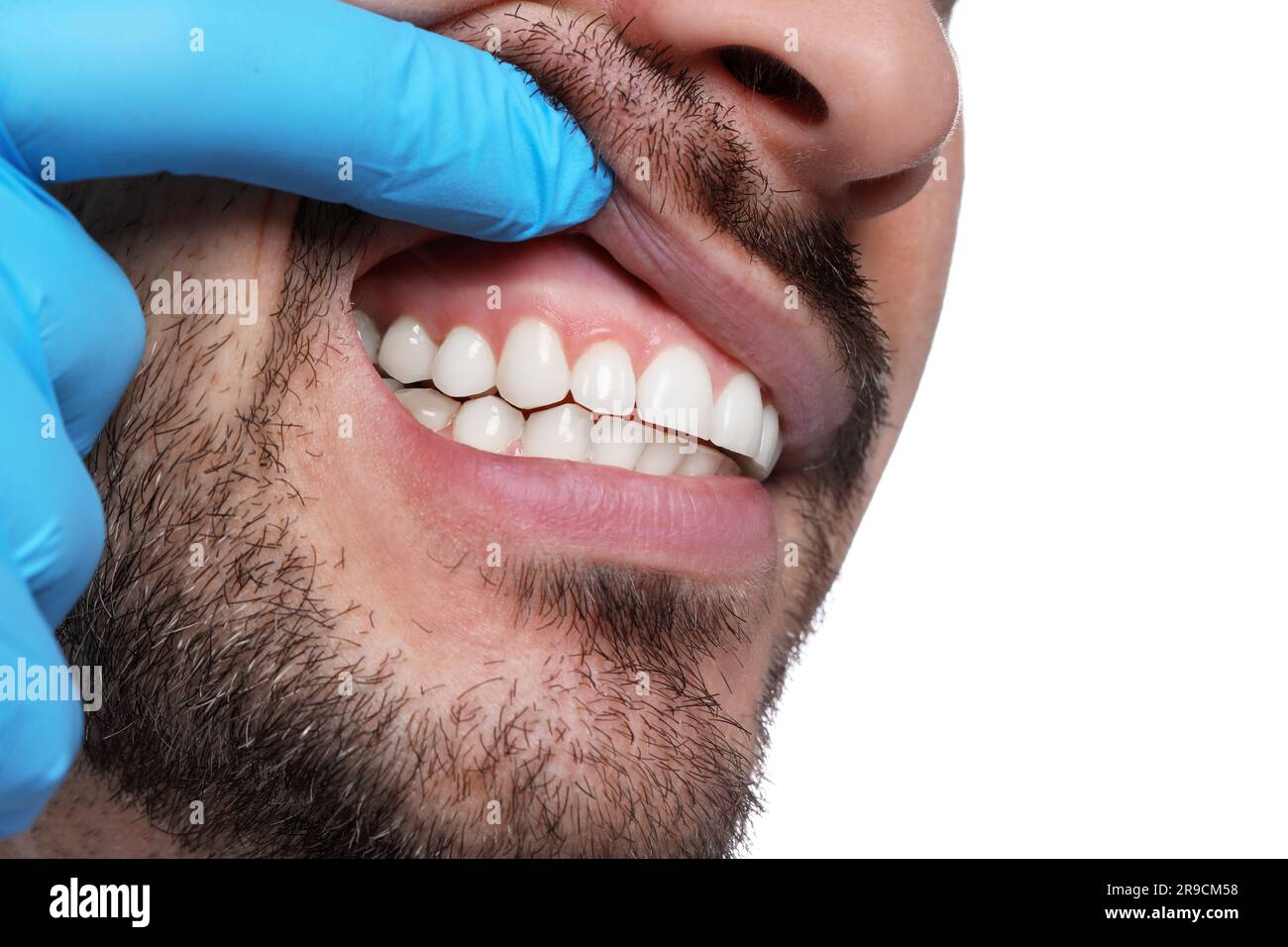 Man showing healthy gums on white background, closeup Stock Photo - Alamy