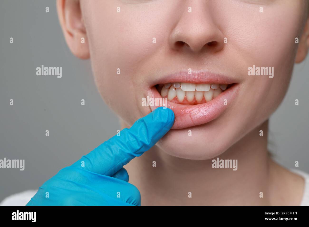 Doctor examining woman's gums on grey background, closeup Stock Photo ...