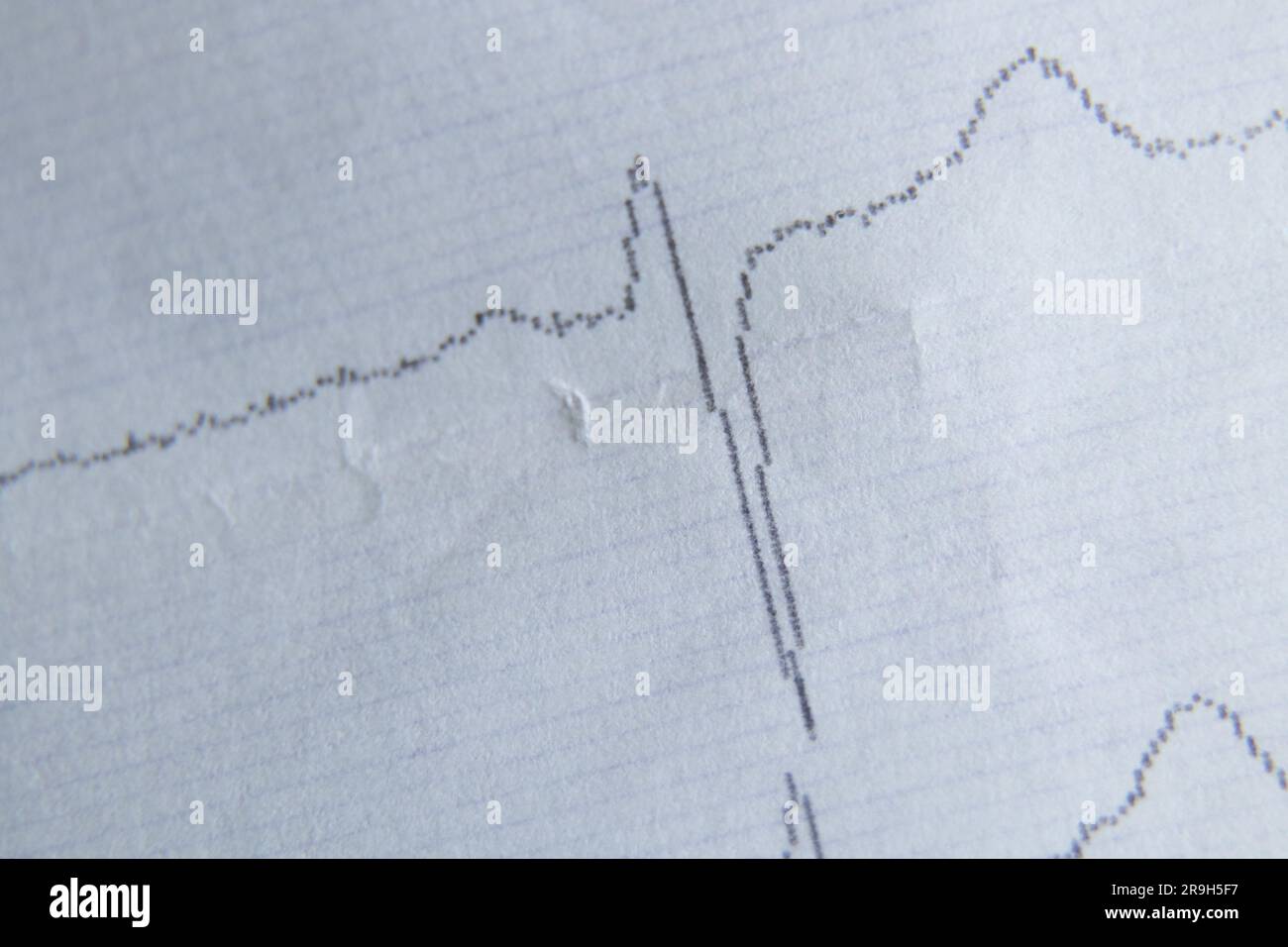 cardiogram on old paper as background macro photo Stock Photo - Alamy