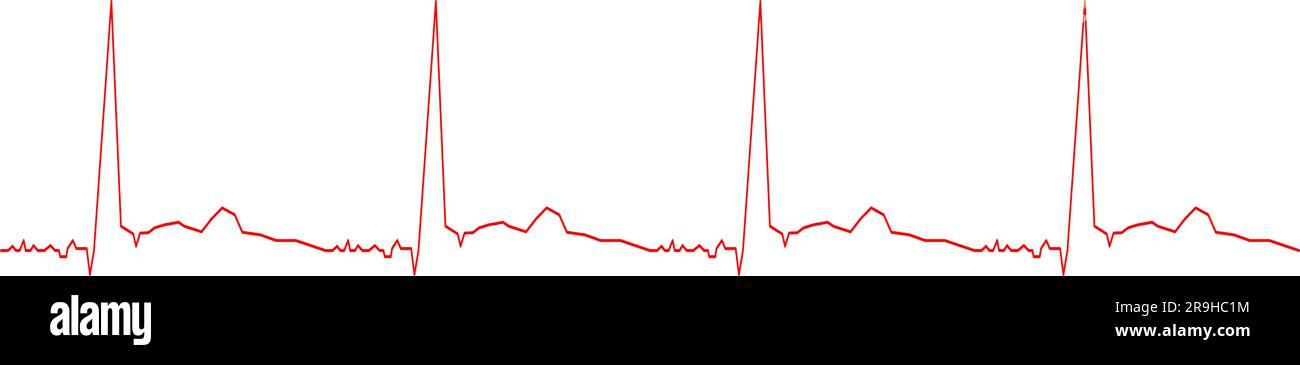 Red heartbeat diagram. Electrocardiogram chart. Heart cardiac rhythm ...