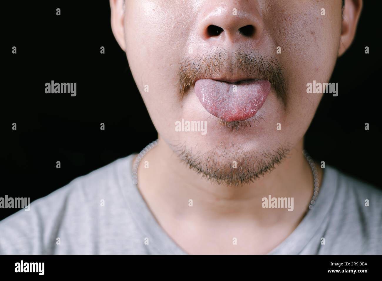 A close-up shot of a partial face of a young Asian man with the tongue ...