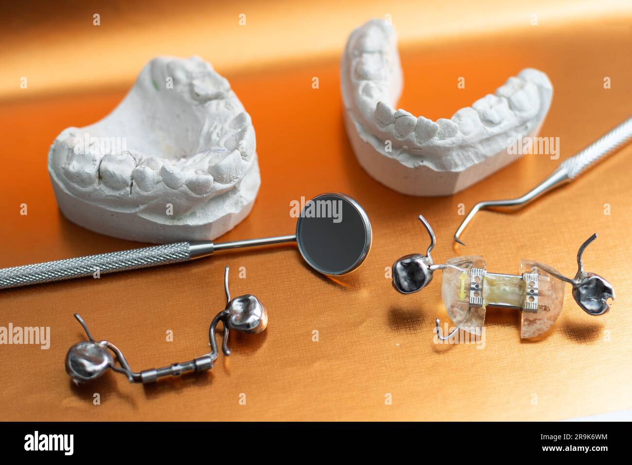 Dental casting gypsum model plaster cast stomatologic human jaws ...