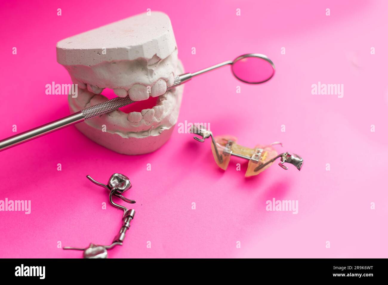 Dental models top view. Jaw models with different problems. Treatment ...