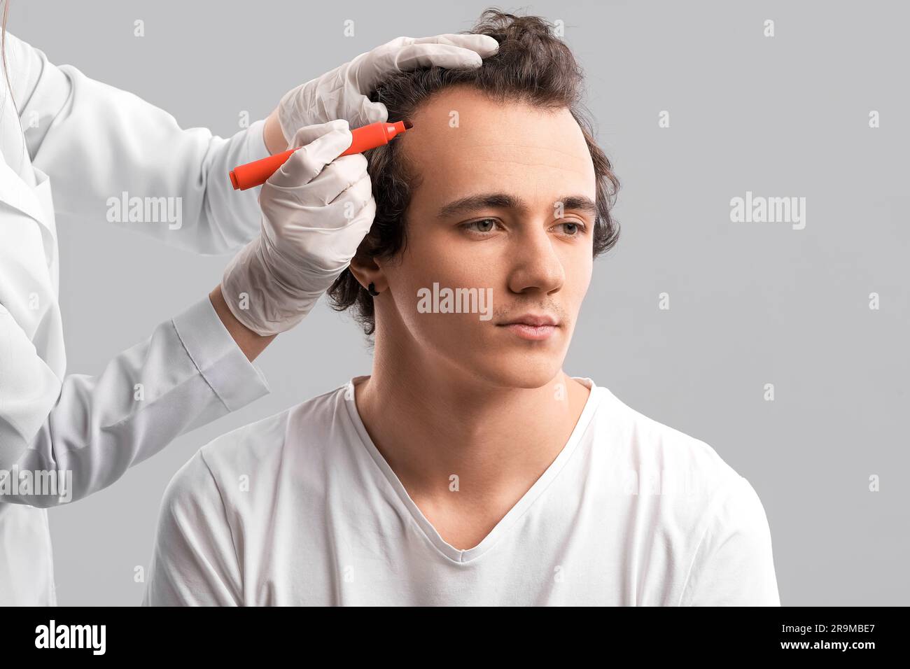 Doctor marking young man's forehead with hair loss problem on grey ...