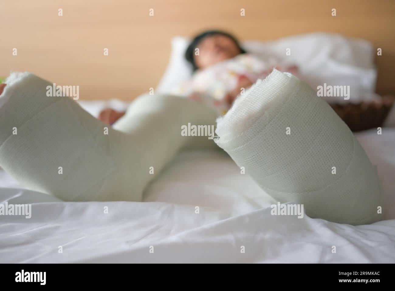 little child with plaster bandage on leg Stock Photo - Alamy