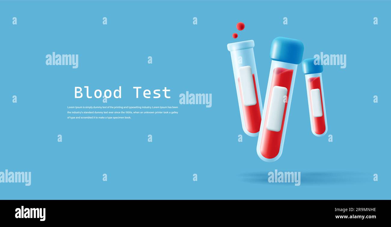 Medical Test blood sample tube beaker with cap and name label, 3d ...