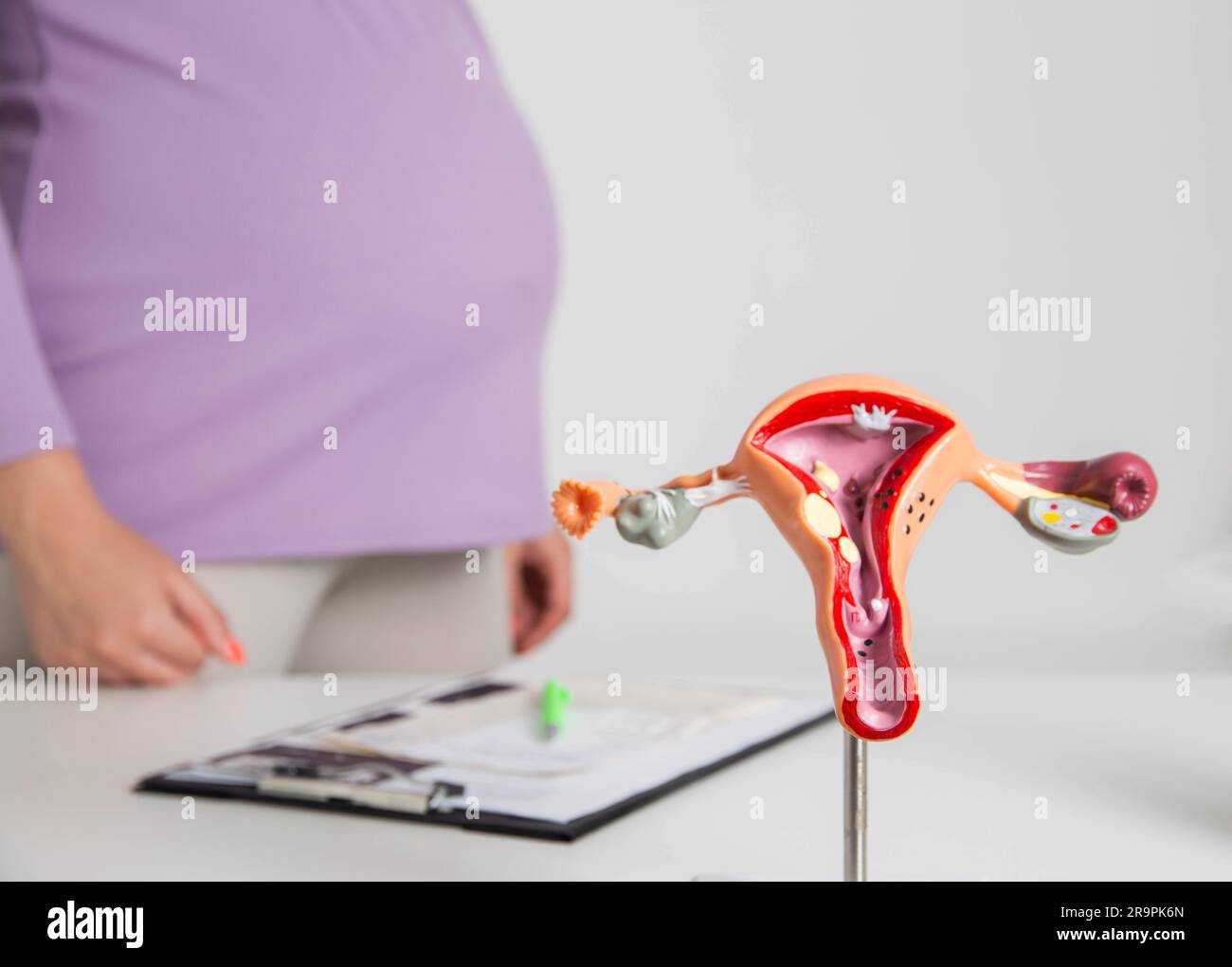 Uterine change hi-res stock photography and images - Alamy
