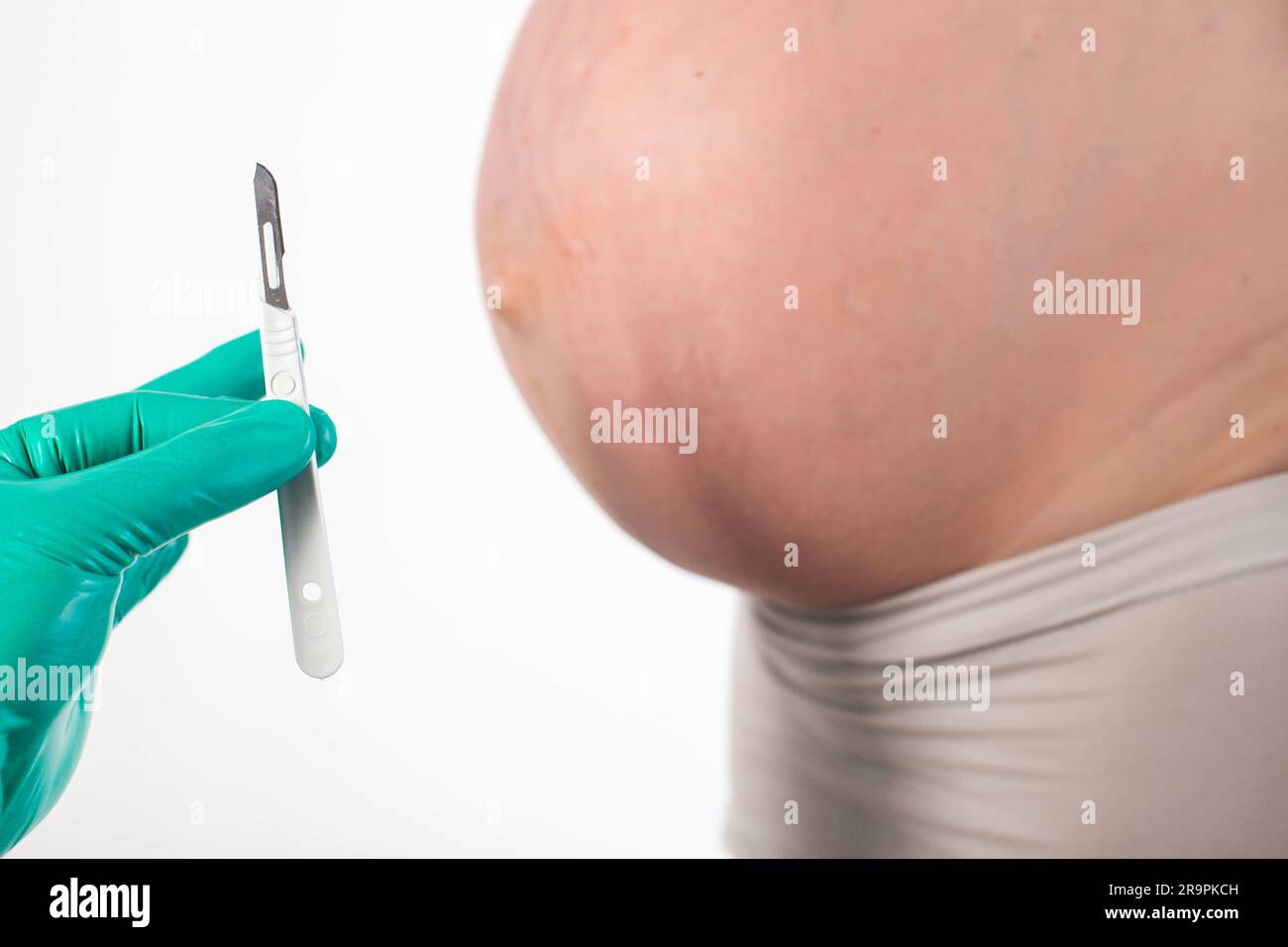 Surgical scalpel on the background of the belly of a pregnant girl. The ...