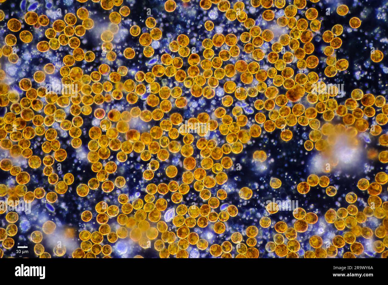 Microscopic photo of symbiotic algae (zooxanthellae) of the ...