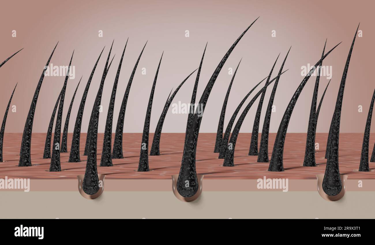 Dried and damaged hair follicles - 3D illustration Stock Photo - Alamy