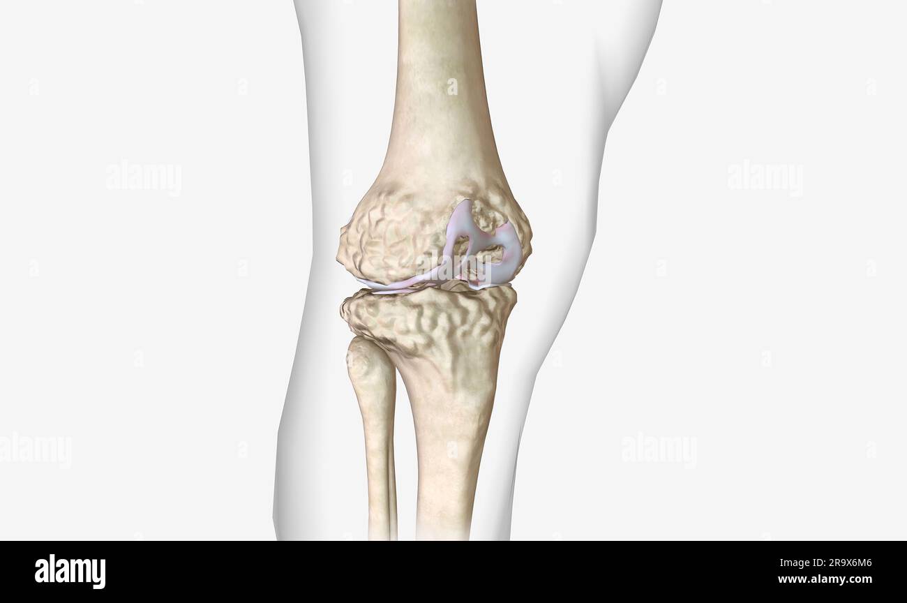 Knee osteoarthritis 3d scan hi-res stock photography and images - Alamy