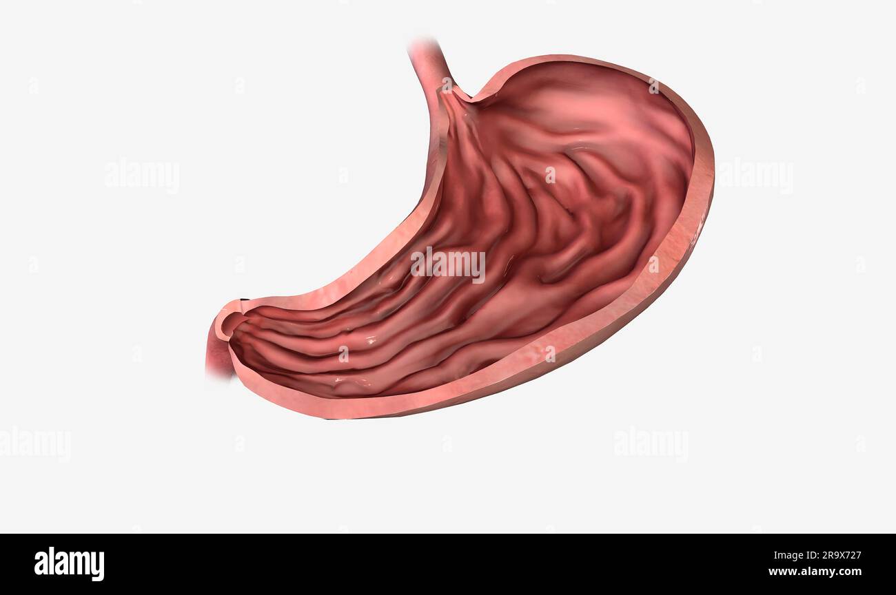 Upper digestive endoscopy hi-res stock photography and images - Alamy