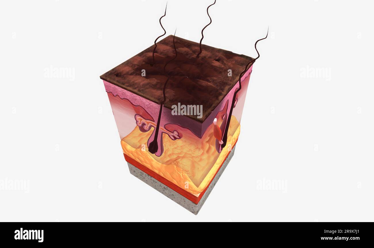 The Melasma in Skin Tissue 3D rendering Stock Photo - Alamy