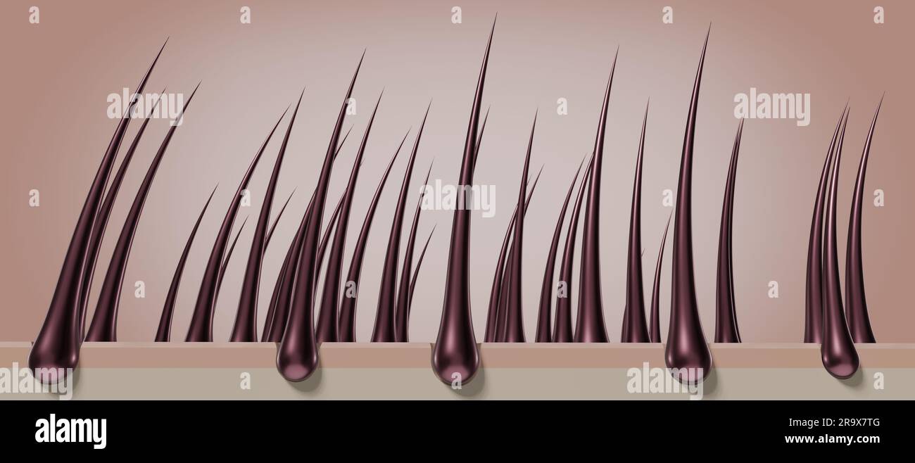 Healthy hair follicles and skin under microscope - 3D illustration ...