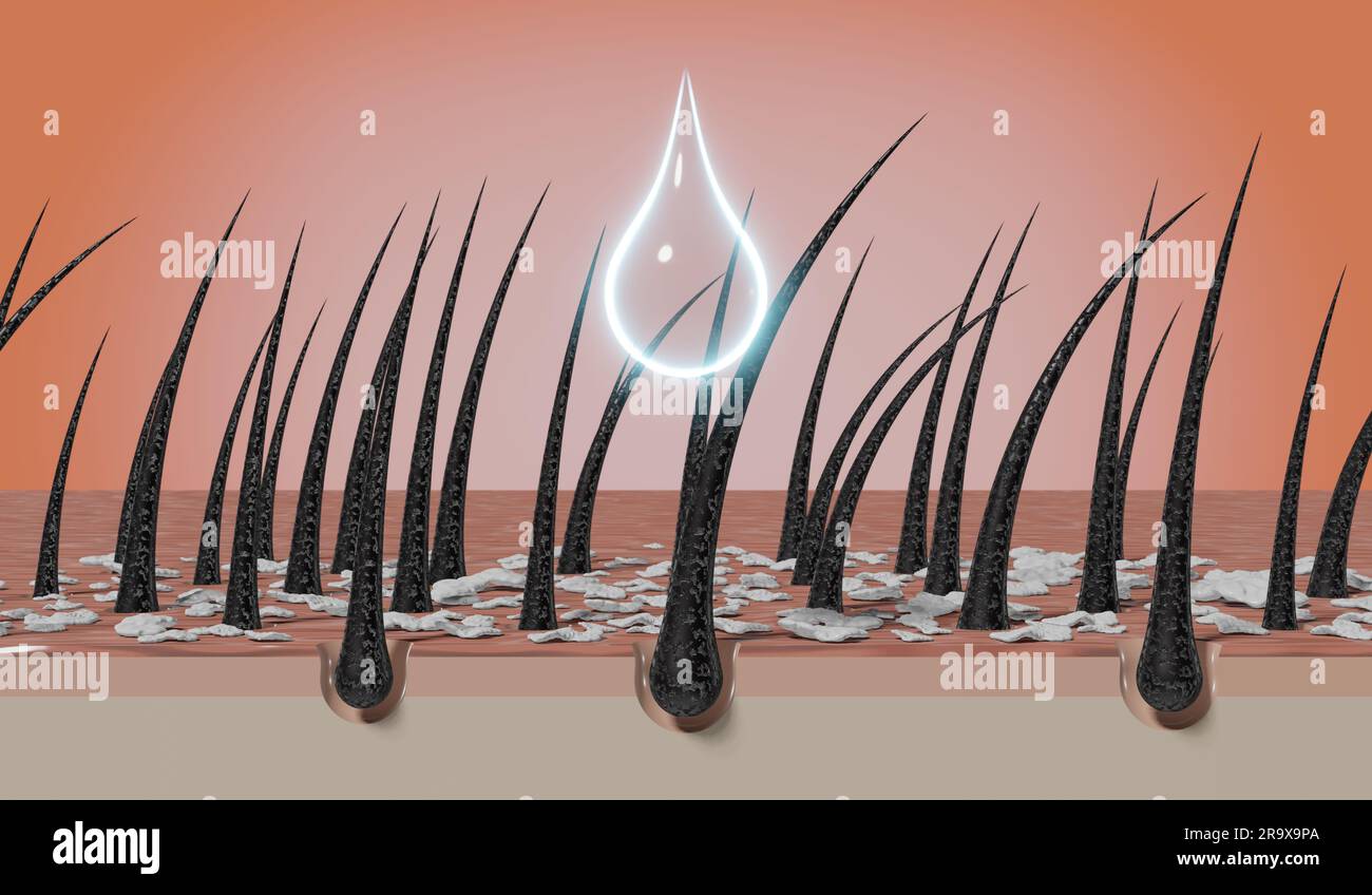 Hair follicles and shampoo treatment against dandruff - 3D illustration ...
