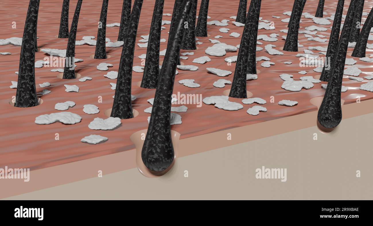 Hair follicles and dandruff under microscope - 3D illustration Stock ...