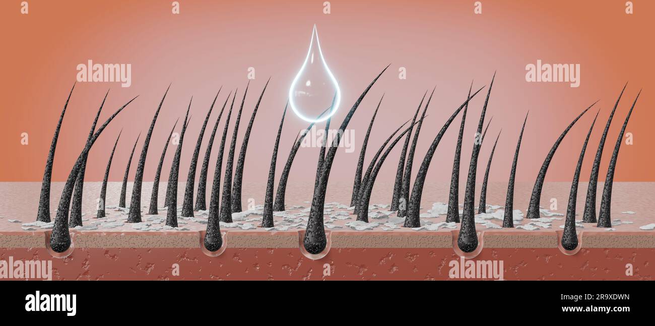 Hair follicles and shampoo treatment against dandruff - 3D illustration ...