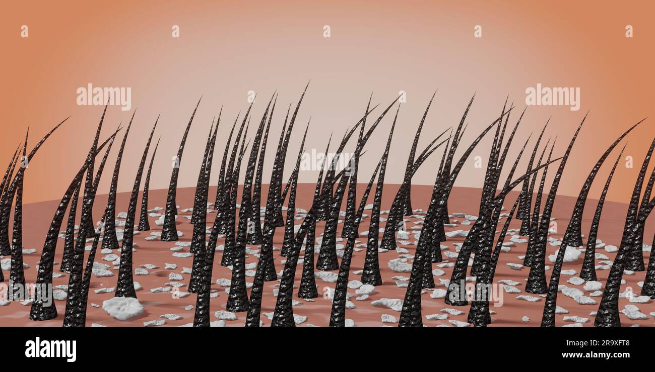 Dandruff Under Microscope