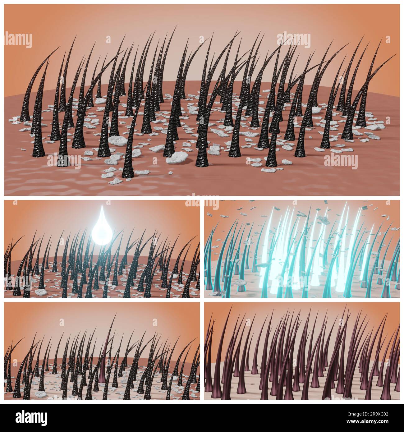 Hair follicles and dandruff - steps in therapy - 3D illustration Stock ...