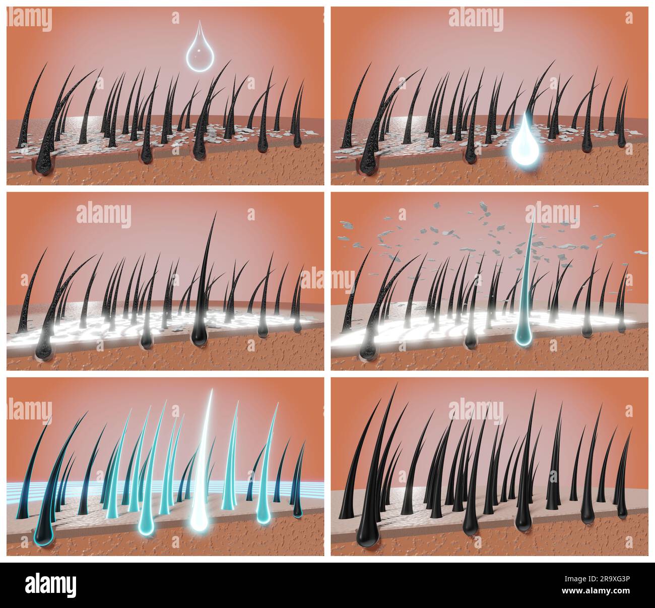 Skin scalp hair follicles Cut Out Stock Images & Pictures - Alamy