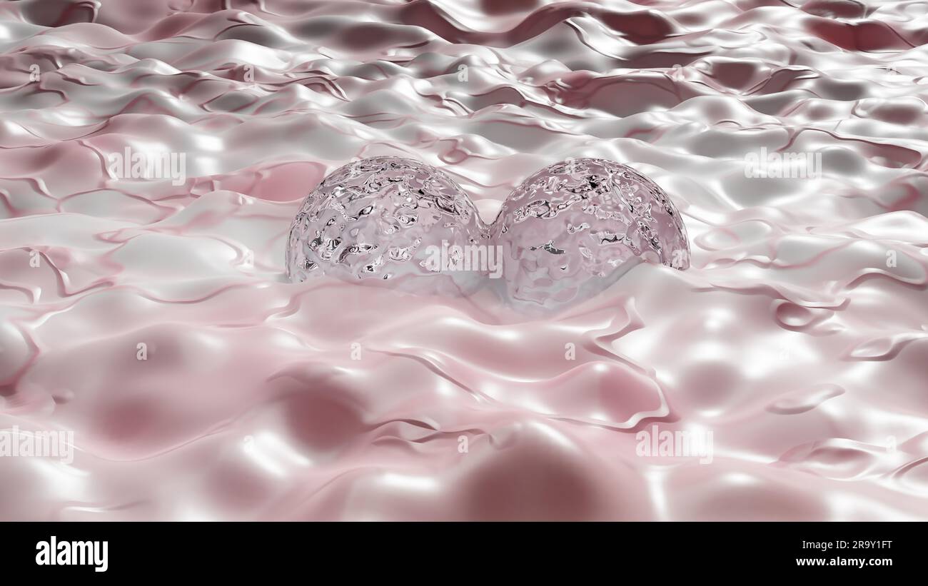 Cancer cell growth uncontrollably over tissue, Tumor infection cells ...